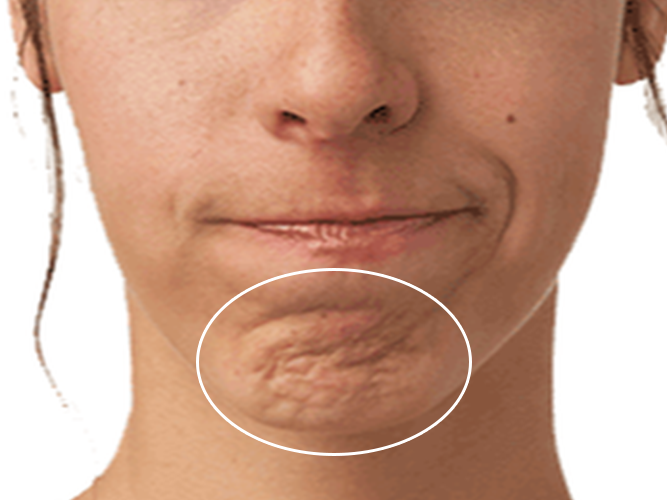 Botox (Botolinum Toxin A) - NOXClinic - Skin · Aesthetic · Laser